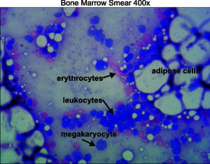 Bone marrow 400x - Dissection Connection